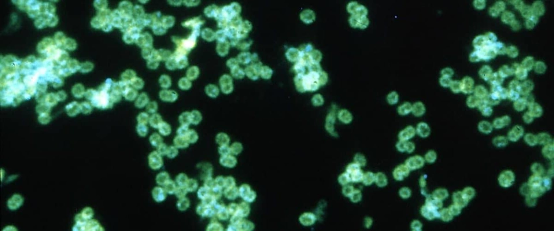 Testing for STDs/STIs: A Primer